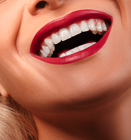Teeth Whitening - Designer Smiles